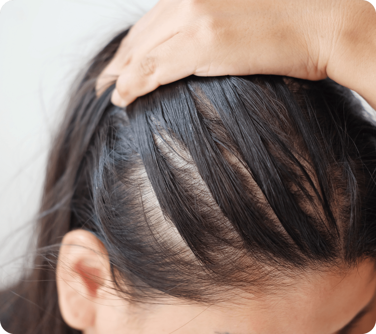 Que+ Hair Growth Serum™: Science-Based Hair Care – Follicle Labs